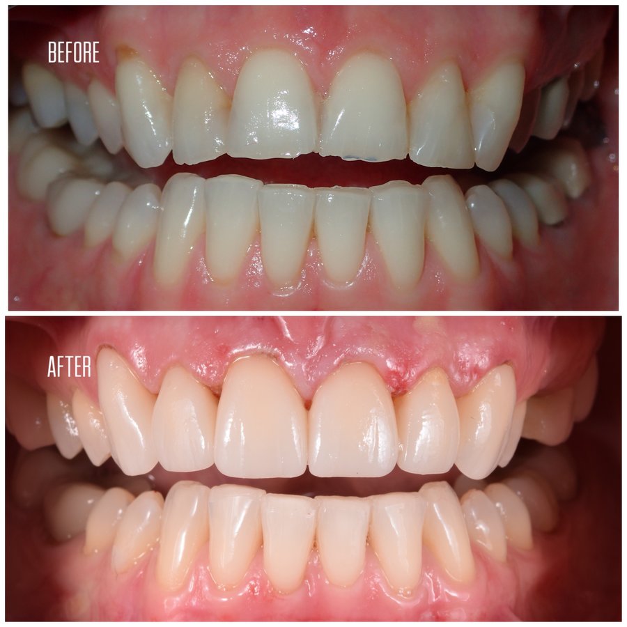 Perfect Smile Dental Implant Center