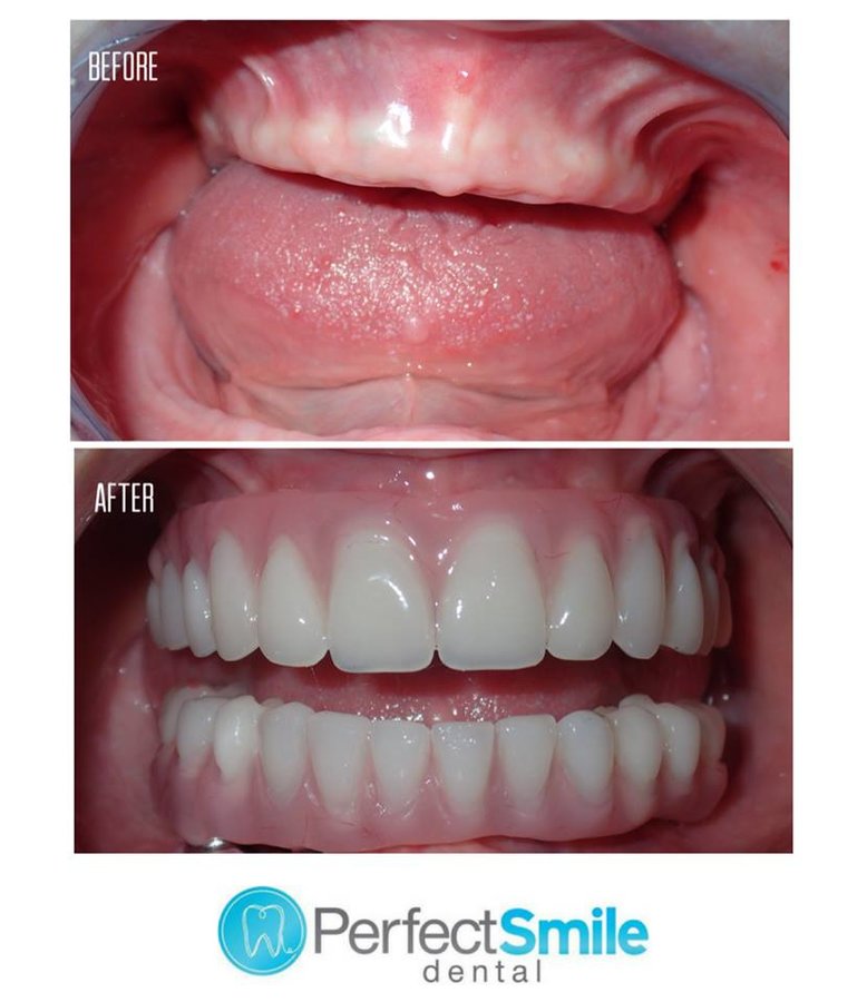 Perfect Smile Dental Implant Center