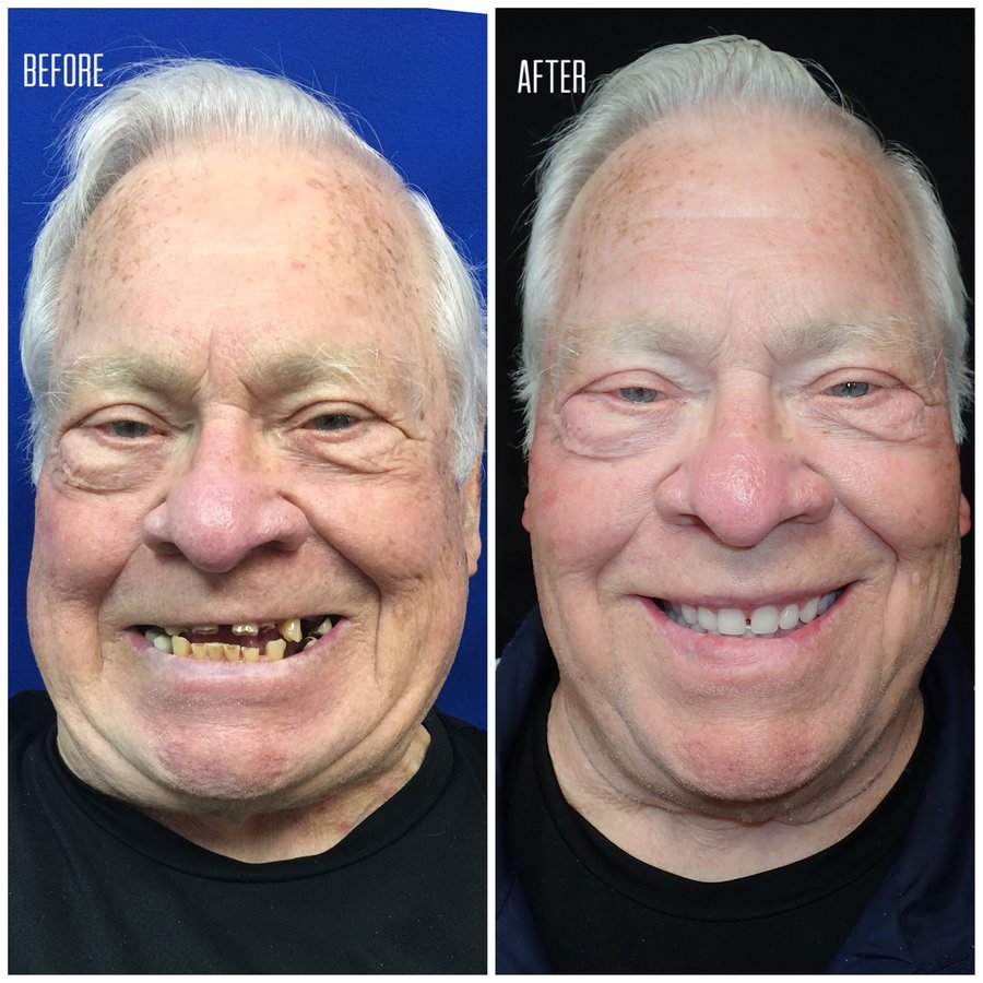 Perfect Smile Dental Implant Center