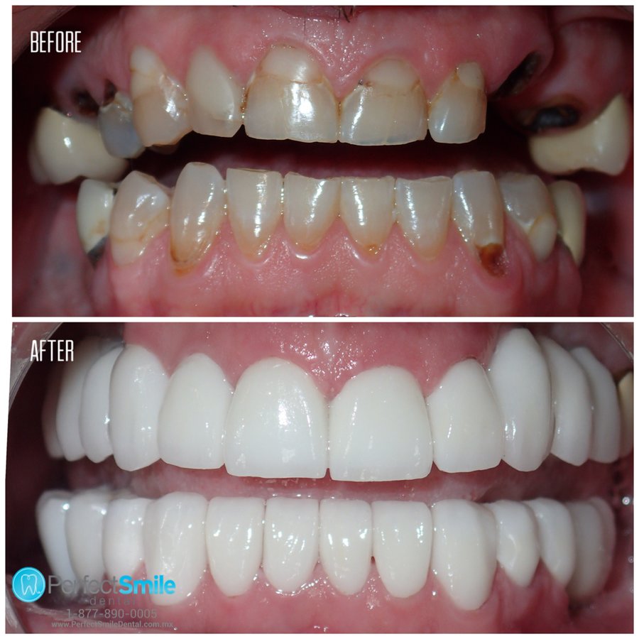 Perfect Smile Dental Implant Center